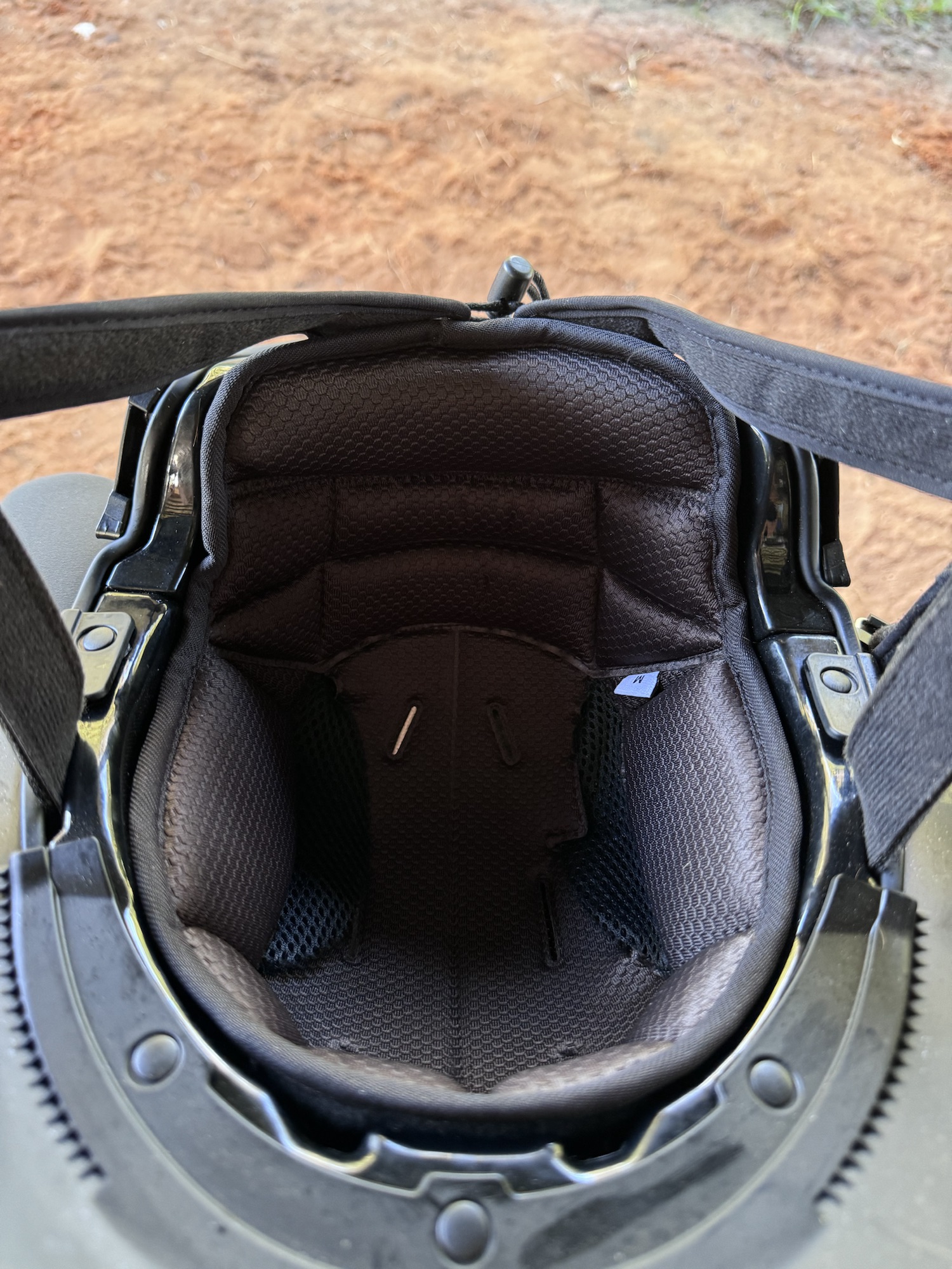 you can really see the additional occipital bone coverage here